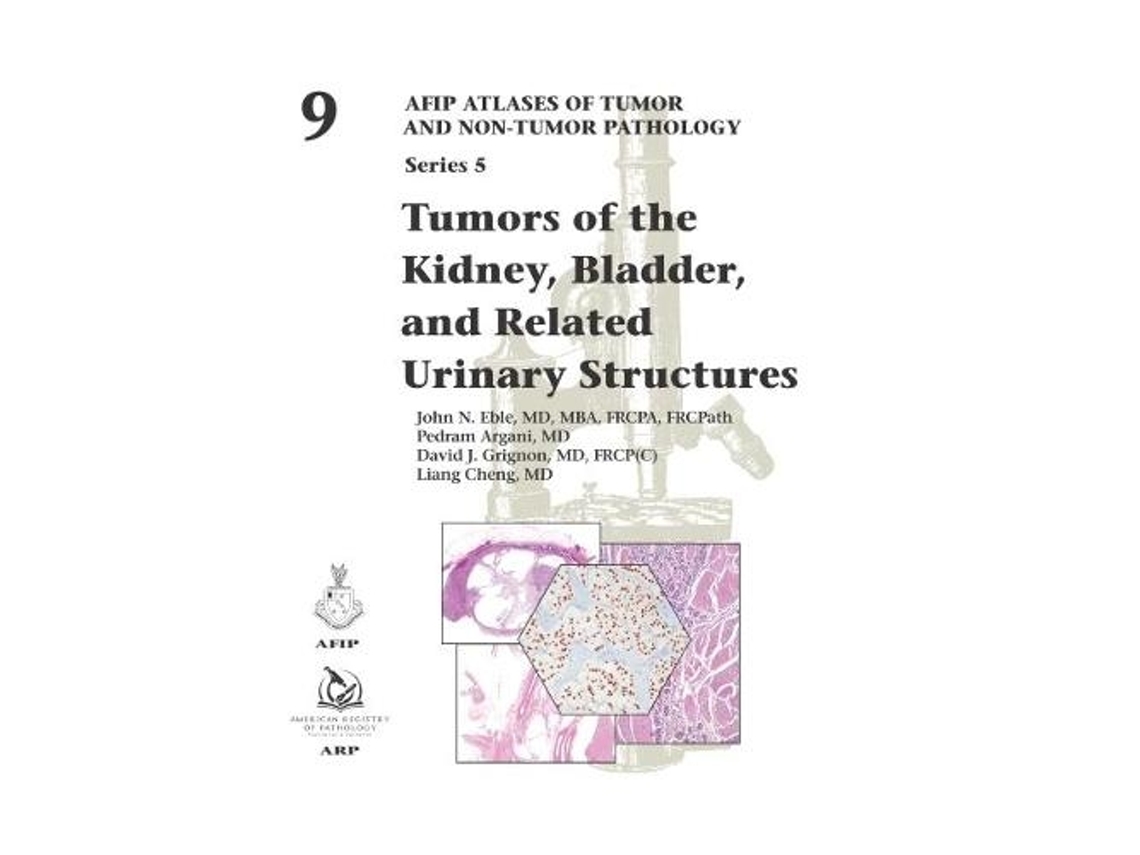 Livro tumors of the kidney, bladder, and related urinary structures de ...