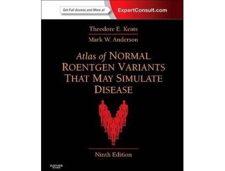 Livro Atlas Of Normal Roentgen Variants That May Simulate Disease de ...