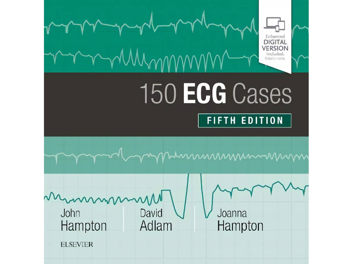 Livro 150 Ecg Cases de Adlam Hampton (Inglês) | Worten.pt