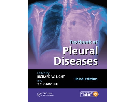 Livro textbook of pleural diseases de edited by richard w light ...